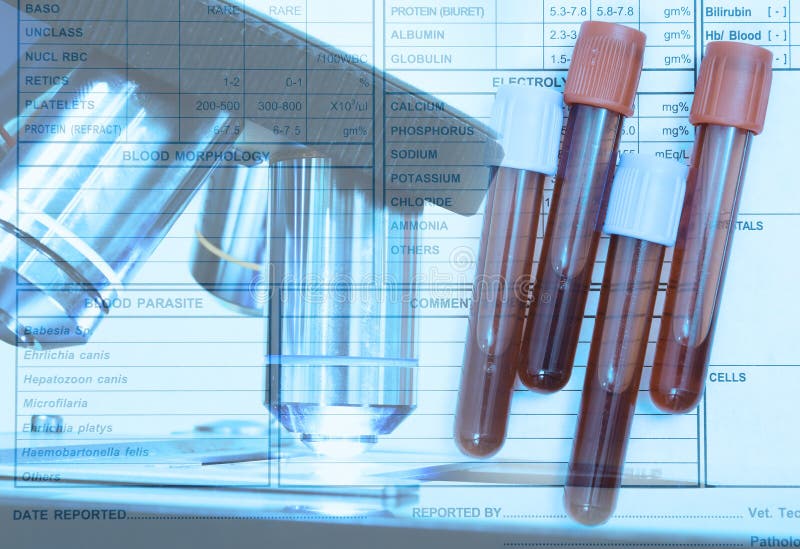 Close Up Shot of Microscope at the Blood Laboratory and Blood Testing ...