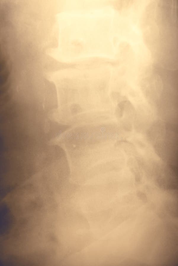 Close up spinal cord bone stock image. Image of anatomy - 91631679