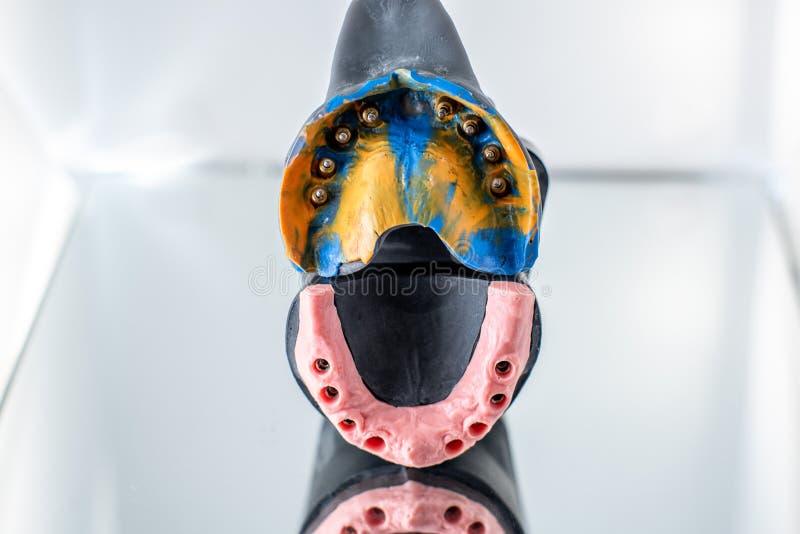 Jaw Impressions for Implants Modeling Stock Image - Image of dental ...