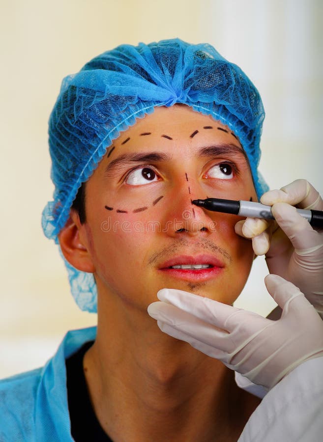 Close Up of a Surgeon Drawing Marks on Male Face. Plastic Surgery ...