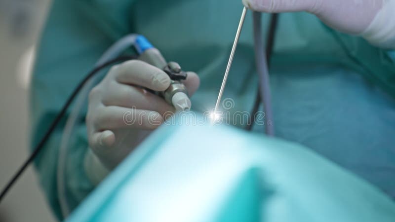 Close-up of a Surgeon S Hand Using a Laparoscopic Instrument with a ...