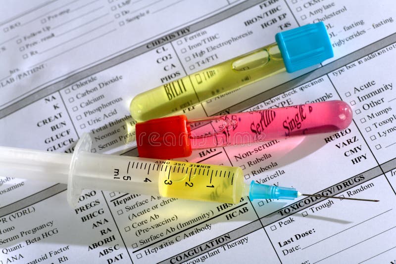 Close Up of Syringe with Test Tube Stock Image - Image of pathology ...