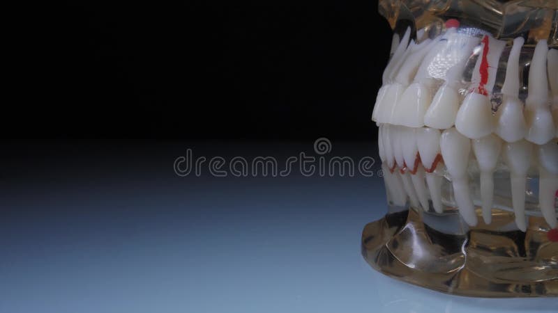 Close - Up of Teeth with Examples of Defects and Bad Teeth Stock Video ...