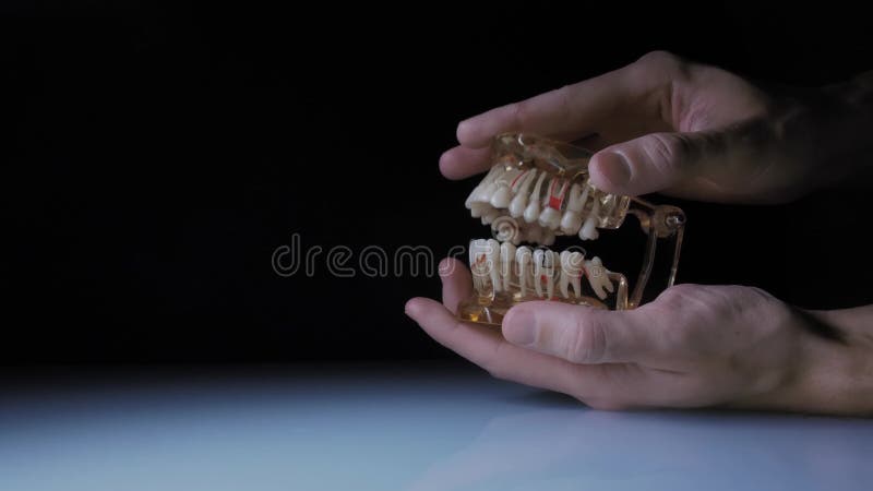 Close - Up of Teeth with Examples of Defects and Bad Teeth Stock Video ...