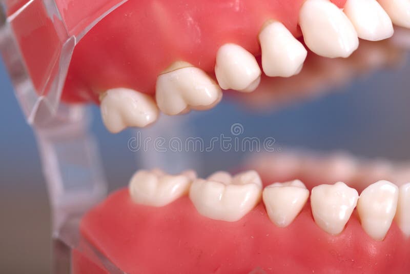 Close-up of Teeth in Oral Model Stock Image - Image of cavity, hygiene ...