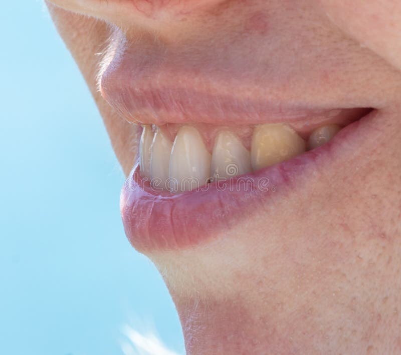 Close-up of Teeth and Smile of a Girl. Macro Stock Photo - Image of ...