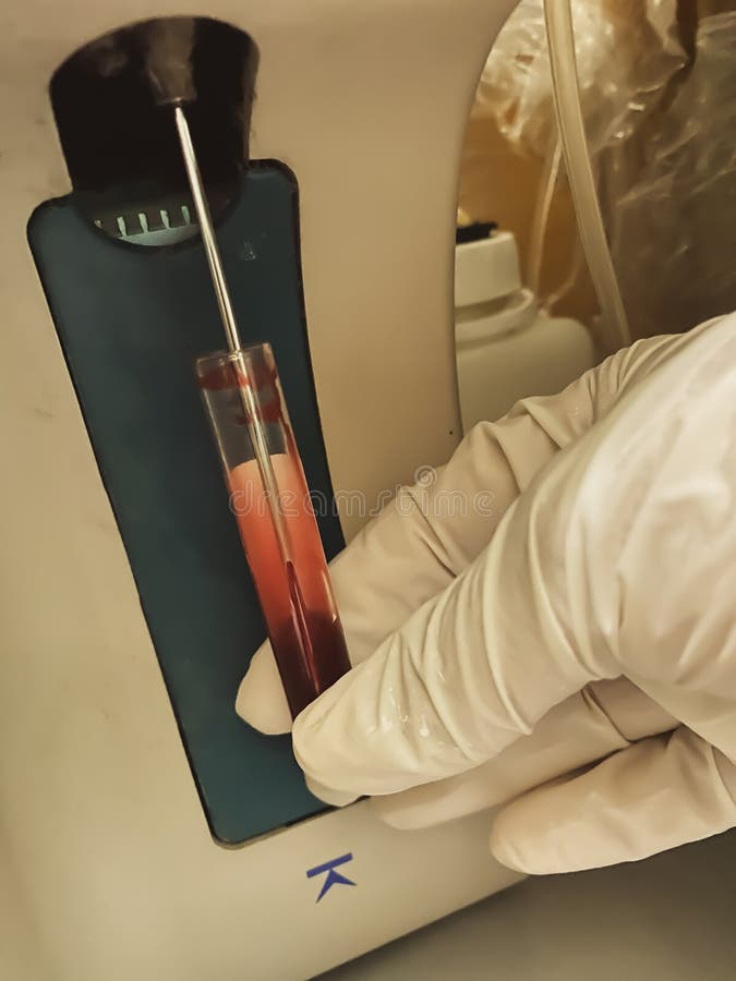 Blood sample testing stock image. Image of hands, checkup - 197461381