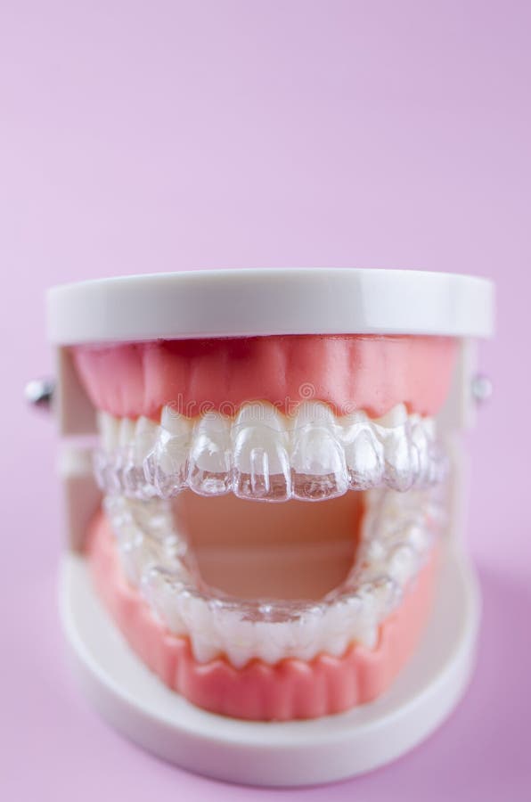 Invisible and Removable Aligners for Teeth Alignment on a Pink ...