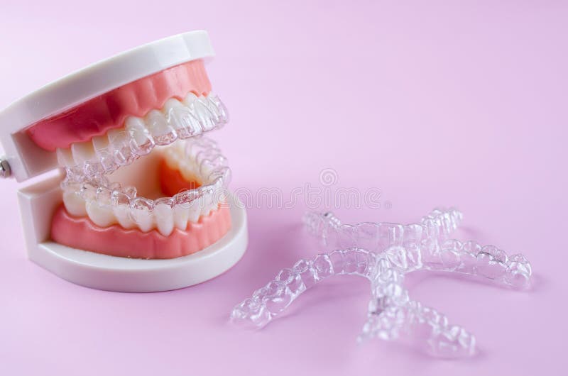 Invisible and Removable Aligners for Teeth Alignment on a Pink ...
