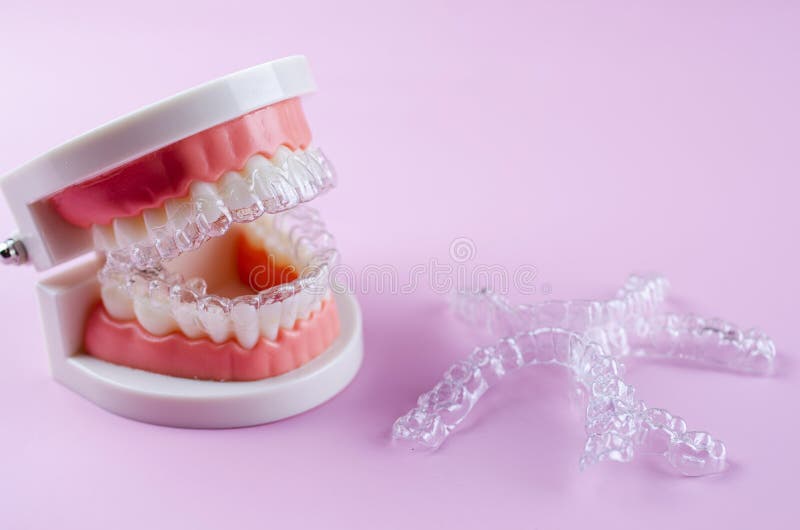 Close-up. Transparent Aligners for Artificial Jaw Teeth on a Pink ...