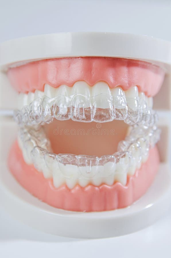 Close-up. Transparent Aligners for Artificial Jaw Teeth on a White ...