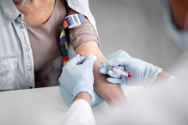 Close Up of Vacuum Blood Collection from the Arm Stock Photo - Image of ... Close Up of Vacuum Blood Collection from the Arm Stock Photo - Image of ...