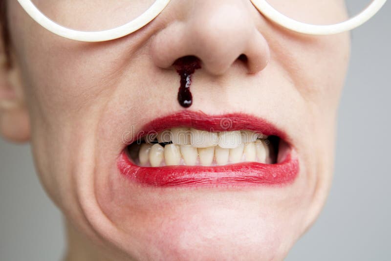 Close-up Van Vrouw Met Neusbloeding Stock Afbeelding - Image of ...