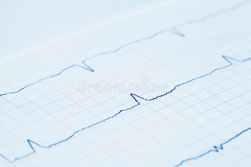 Close-up View On Cardiogram (blue Toned) Stock Image - Image of ...
