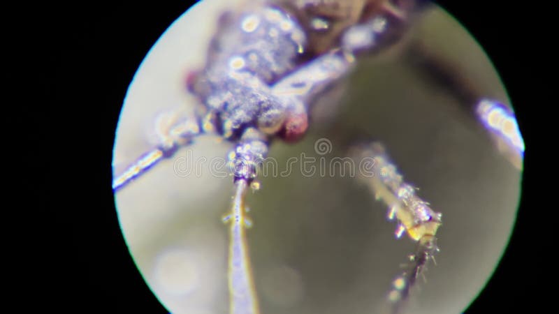 Extreme Close-up of an Insect Moving Its Legs Under a Microscope Stock Video - Video of ...