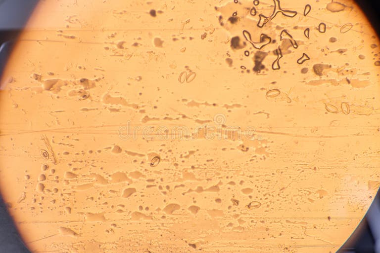 Close Up View Under the Microscope. Close Up of Worm Eggs and Bacteria ...