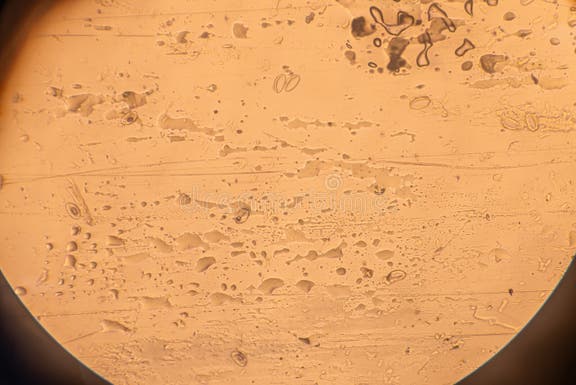 Close Up View Under the Microscope. Close Up of Worm Eggs and Bacteria. Stock Photo - Image of ...