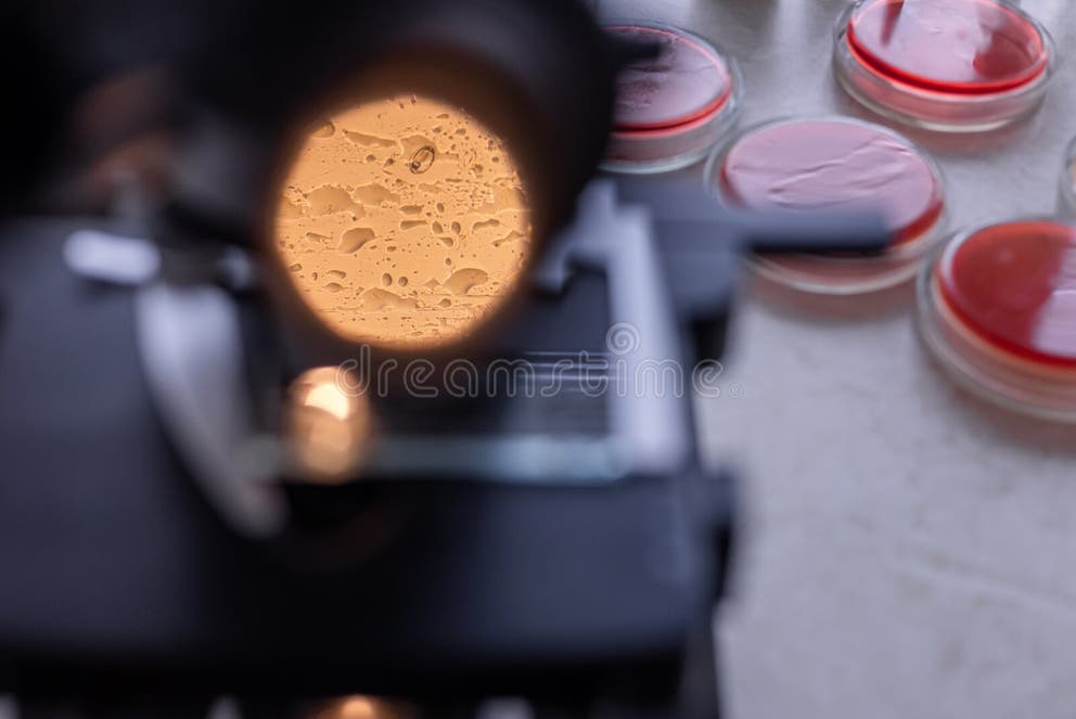 Close Up View Under the Microscope. Close Up of Worm Eggs and Bacteria ...