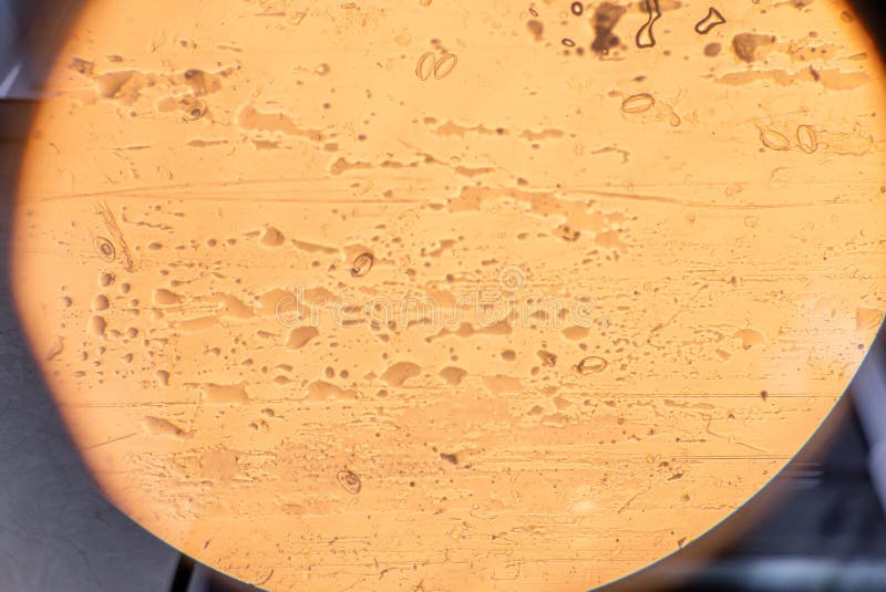 Close Up View Under the Microscope. Close Up of Worm Eggs and Bacteria ...