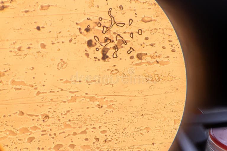 Close Up View Under the Microscope. Close Up of Worm Eggs and Bacteria ...