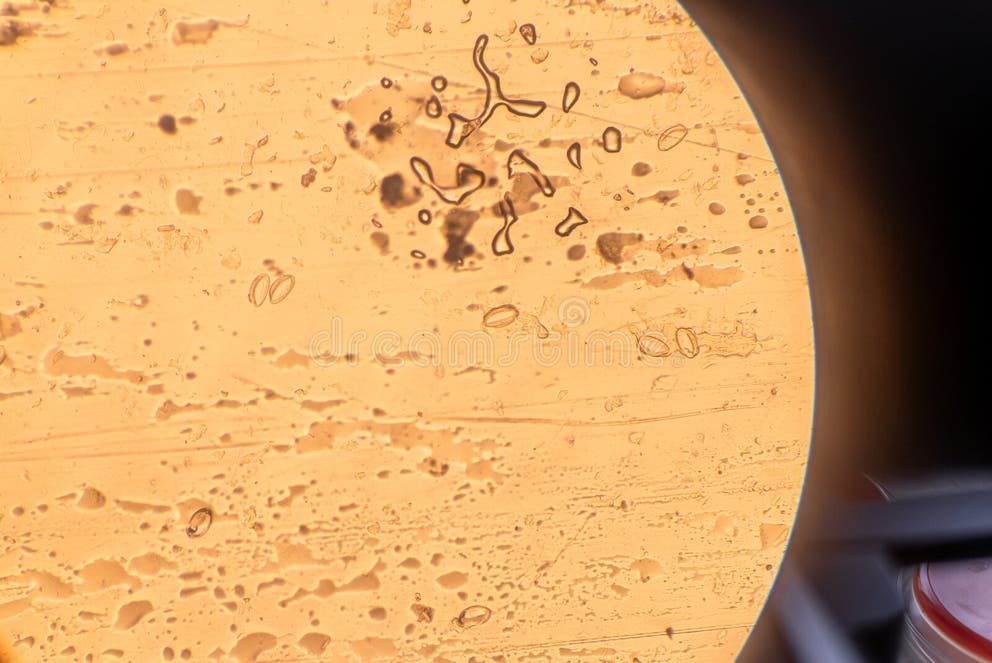 Close Up View Under the Microscope. Close Up of Worm Eggs and Bacteria ...