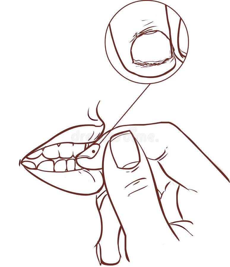 Biting Stock Illustrations – 4,934 Biting Stock Illustrations, Vectors ...