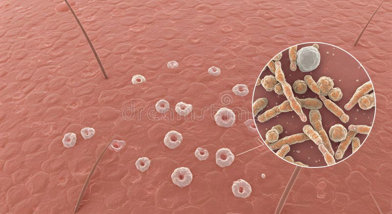 Detailed View of Skin Surface Revealing Bacteria, Immune Cells, and ...