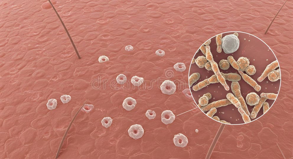 Detailed View of Skin Surface Revealing Bacteria, Immune Cells, and ...