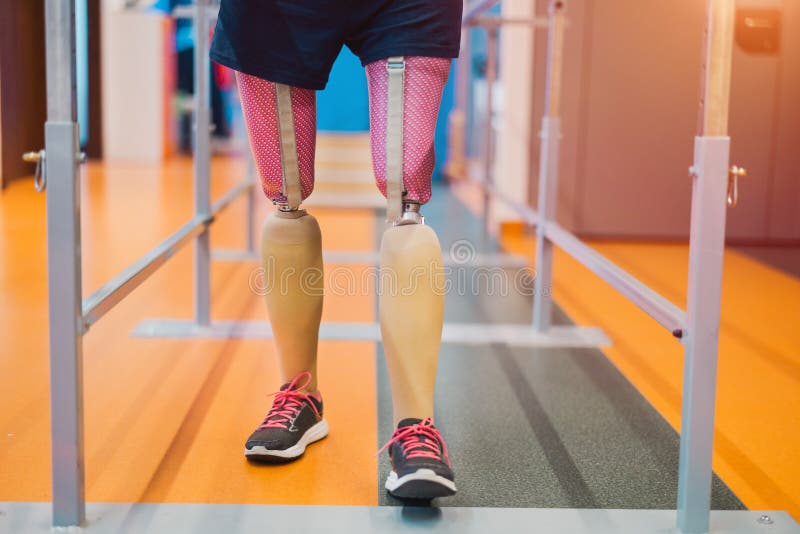 Woman with Prosthetic Legs Using Parallel Bars Stock Image - Image of ...