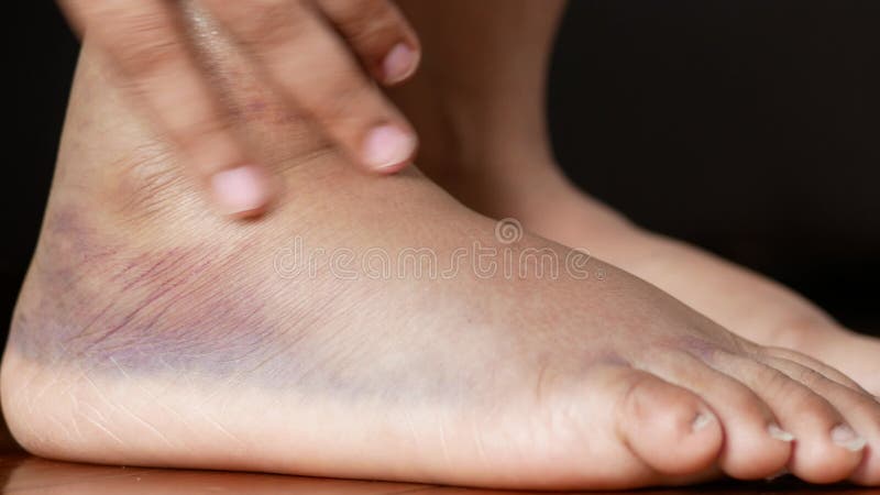 Close-up Swelling of the Tongue. Allergic Reactions, Infections ...