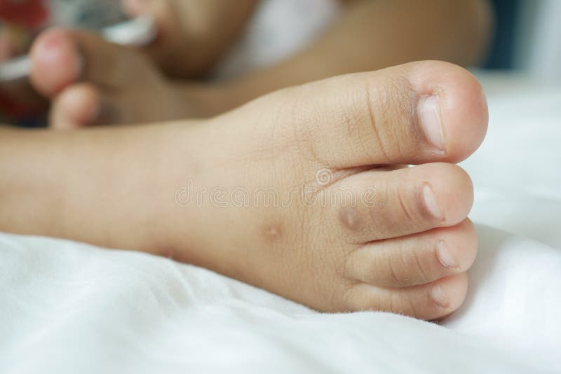 Close Up of 5 Years Old Child Dry Feet on Bed Stock Photo - Image of ...