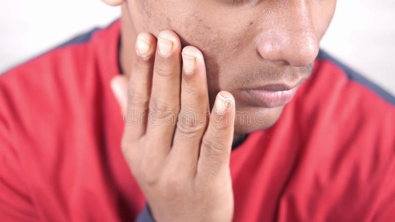 Close Up of Young Asian Man Face with Skin Problem Isolated on White ...