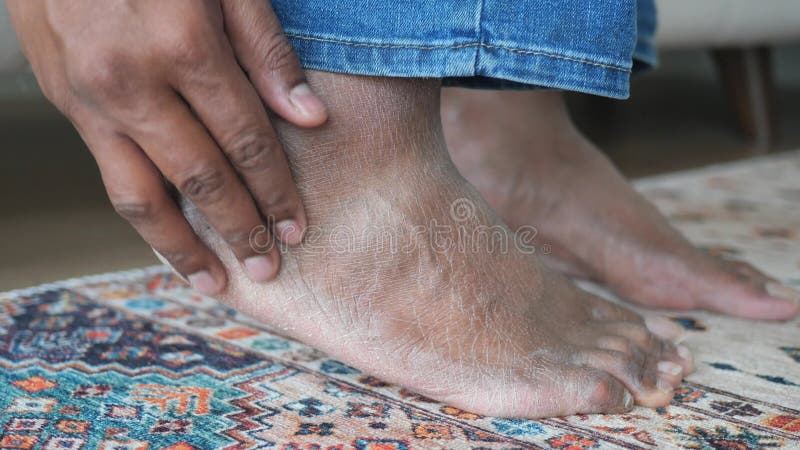 Close Up of Young Men Dry Feet Stock Video - Video of bare, human: 326871145