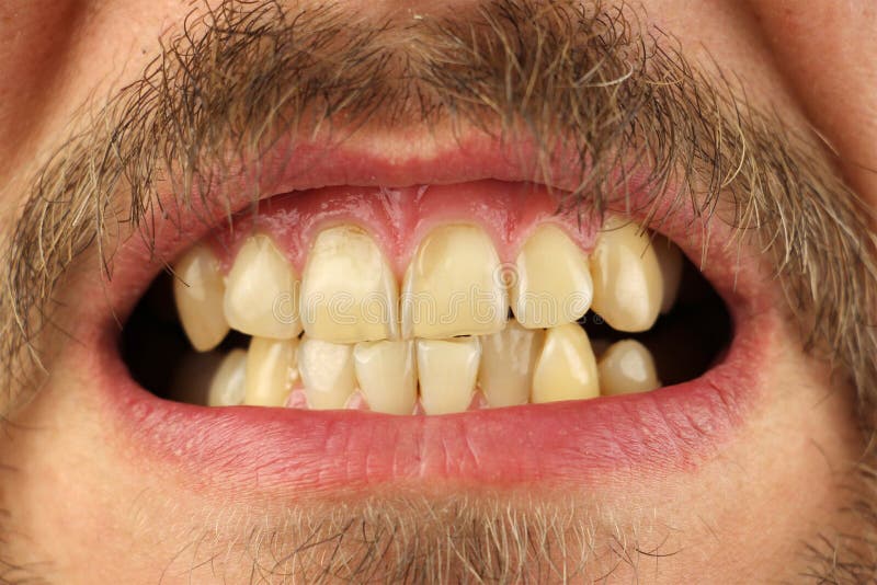 51,038 Grin Photos - Free & Royalty-Free Stock Photos from Dreamstime