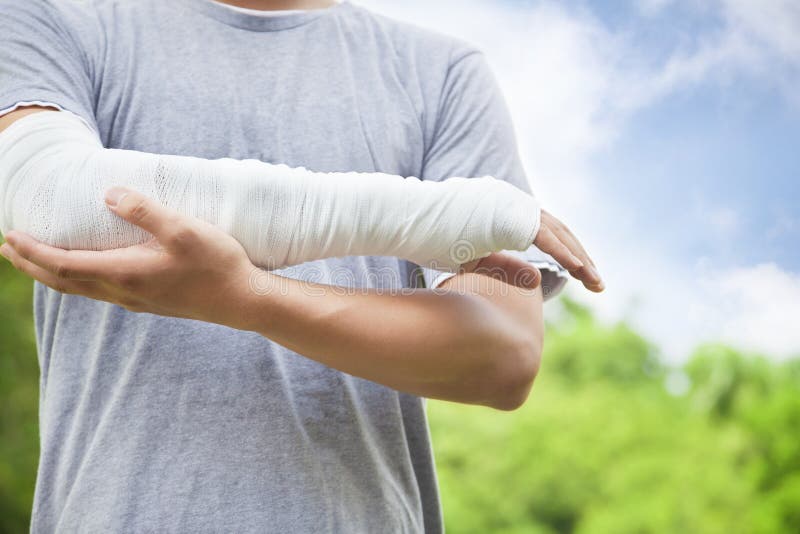 Closeup of Bandaged Arm in the Park Stock Photo - Image of medicare ...