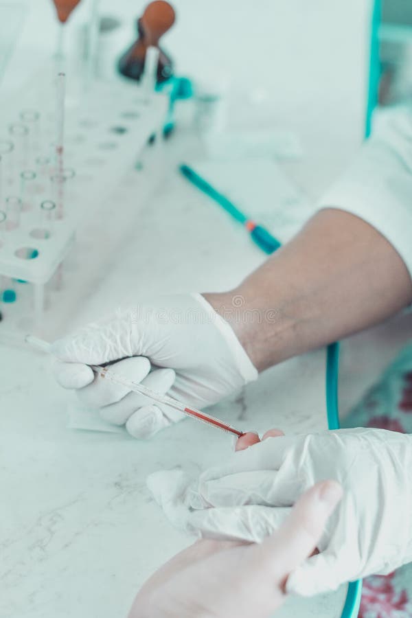 Closeup of Blood Sampling from Finger, Lab Technician and Patient Hands ...
