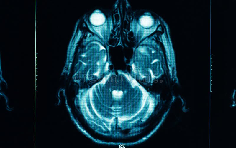 Closeup of a CT scan stock photo. Image of laboratory - 25834016