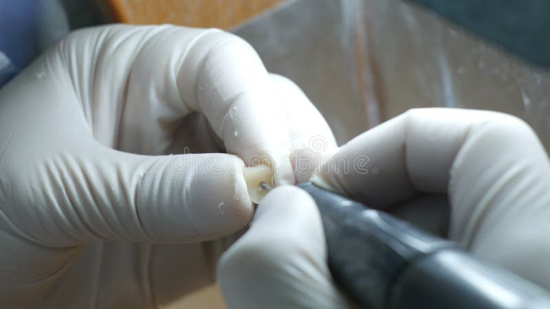 Dental Technician Looking at Plaster Cast of Jaws while Making Denture ...