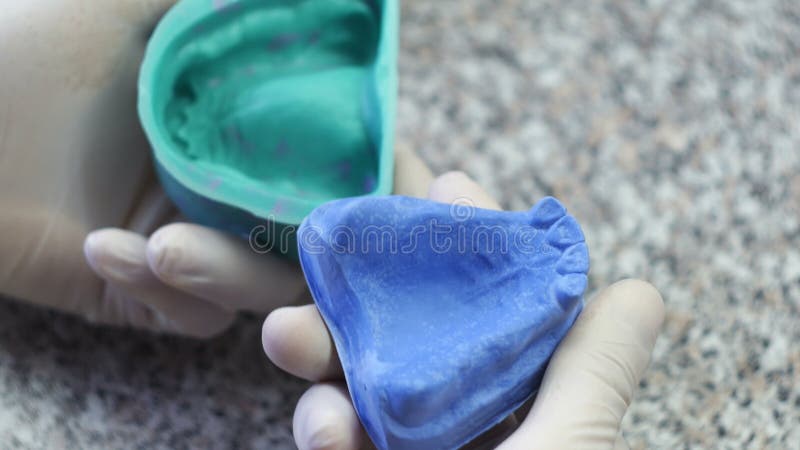 Dental Technician Looking at Plaster Cast of Jaws while Making Denture ...