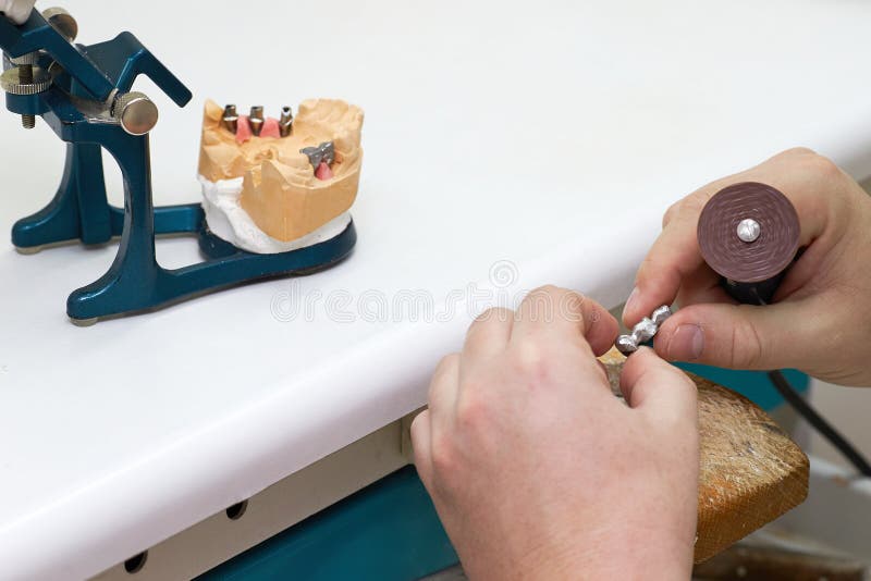 Closeup of a Dentist Technician Working Stock Photo - Image of dentist ...