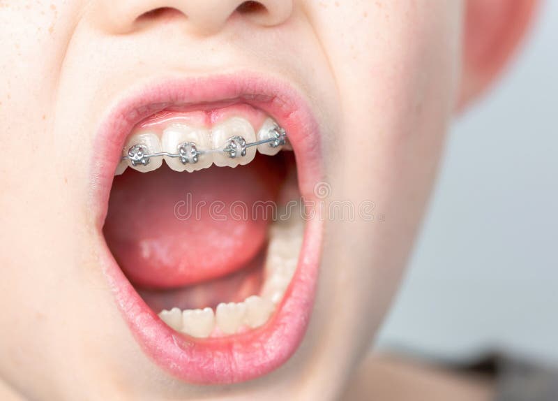 Dentist Using an Instrument To Visualize the Teeth of a Child Patient ...
