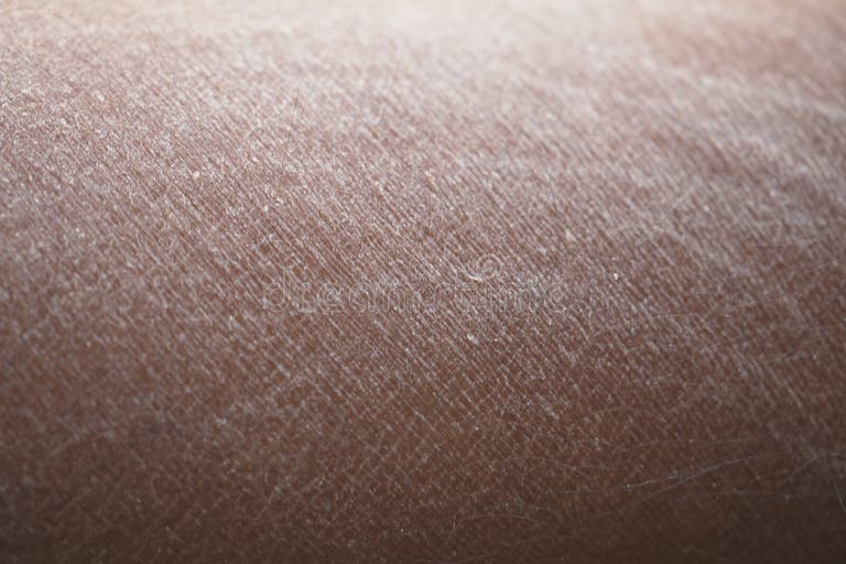 Closeup of Dry Skin Texture Stock Photo - Image of weather, dermis ...