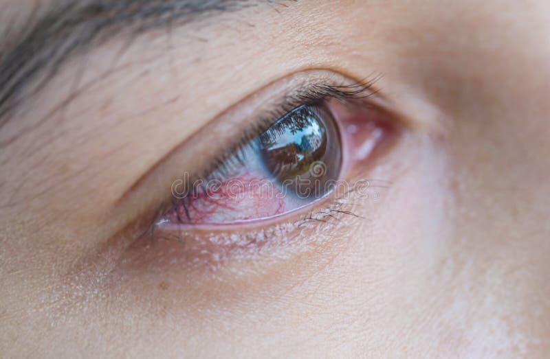 Broken eye stock image. Image of white, eyeblue, pupil - 551299