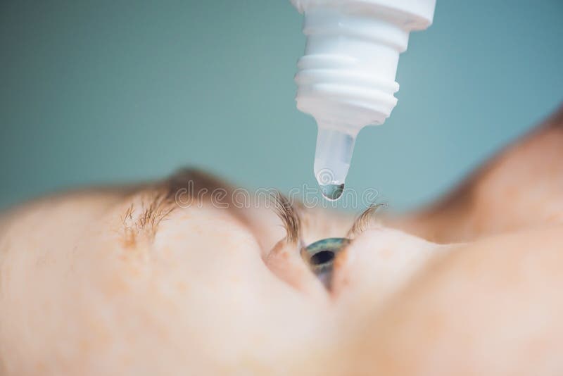 Closeup of Eyedropper Putting Liquid into Open Eye Stock Photo - Image ...