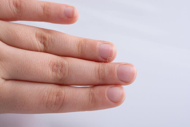 Fingers of a Person with Impaired Vision Stock Photo - Image of ...