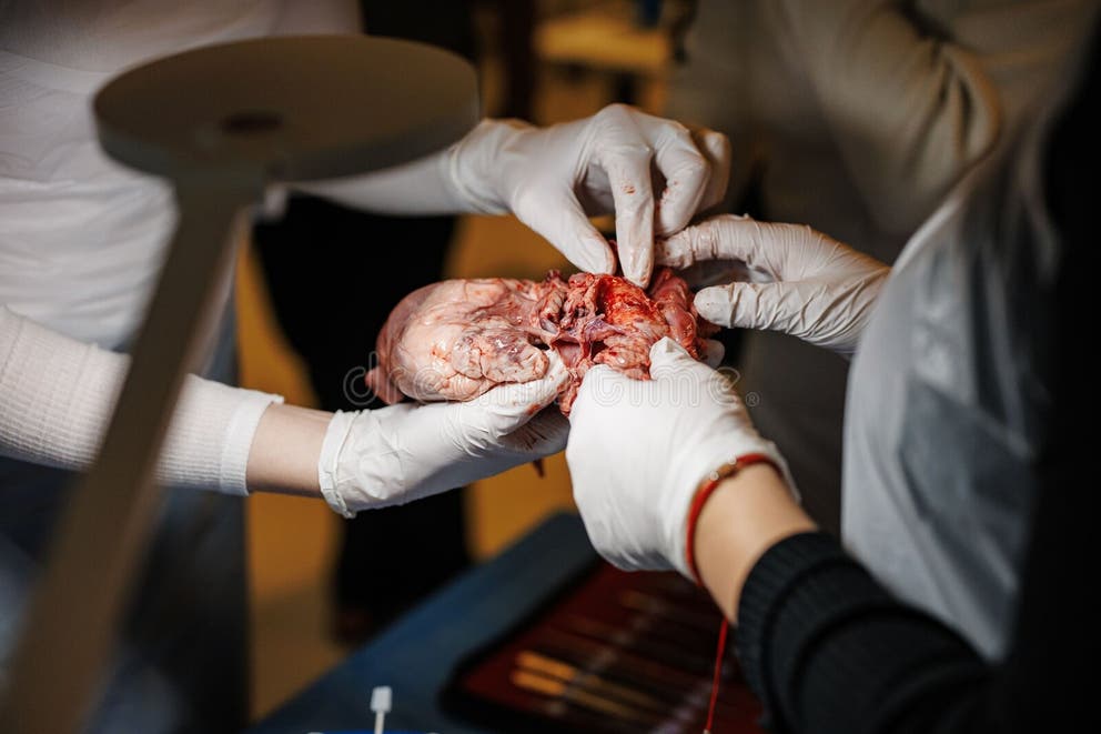 Closeup of Hands in Gloves Examining a Heart during a Dissection ...