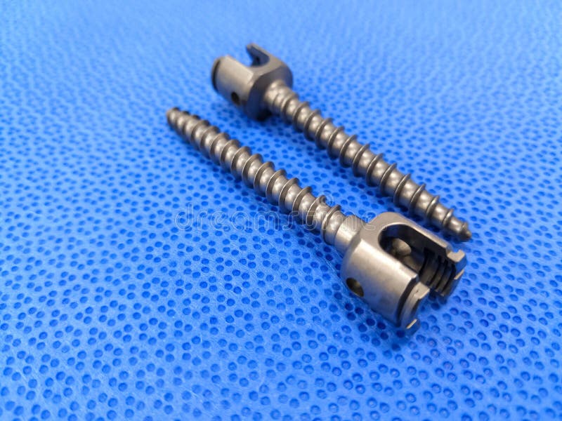 Spinal Pedicle Screws in Blue Background Stock Photo - Image of pedicle ...