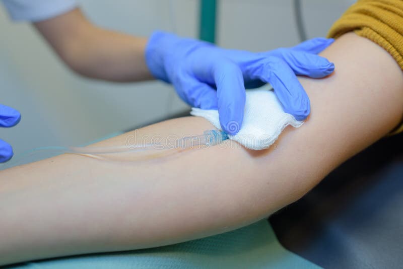 Closeup Intravenous Drip in Arm Stock Photo - Image of procedure, work ...