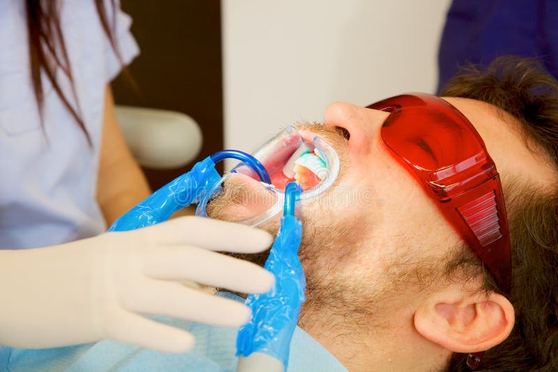 Closeup of Man Getting Teeth Whitening Stock Image - Image of mouth ...