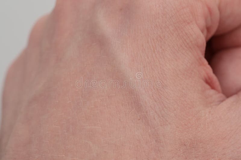 Closeup of Man Hand Skin with Visible Veins Stock Image - Image of body ...